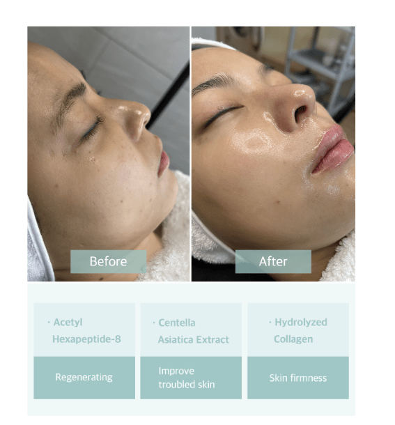 Stayve AC Stem Cell Gold Ampoule Kit - My Beauty and Glow Cosmetics