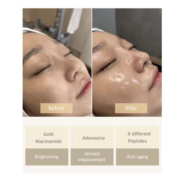 Stayve EGF Peptide Gold Serum Ampoule Kit - My Beauty and Glow Cosmetics